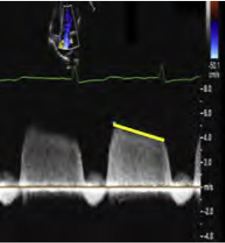 AR-PHT – Cardioplaner